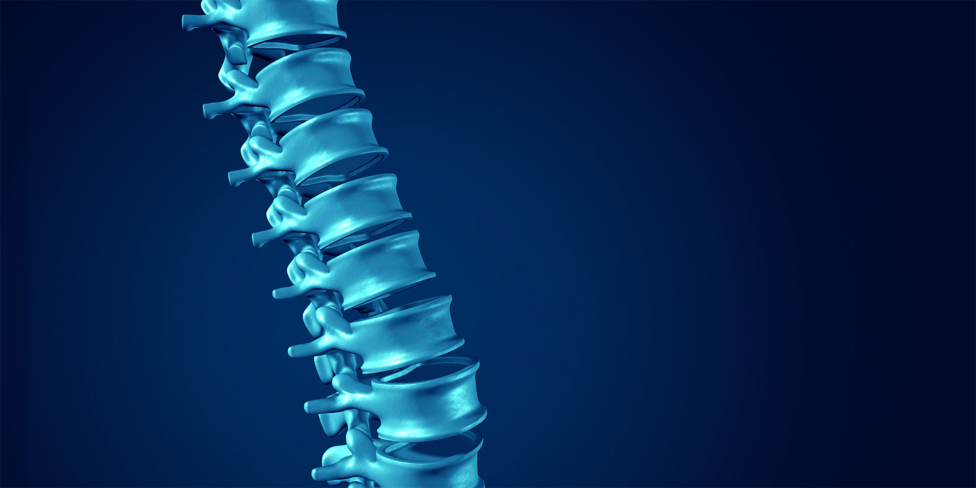 Spinal Instability Testing - Multi-Specialty Medical Consultants